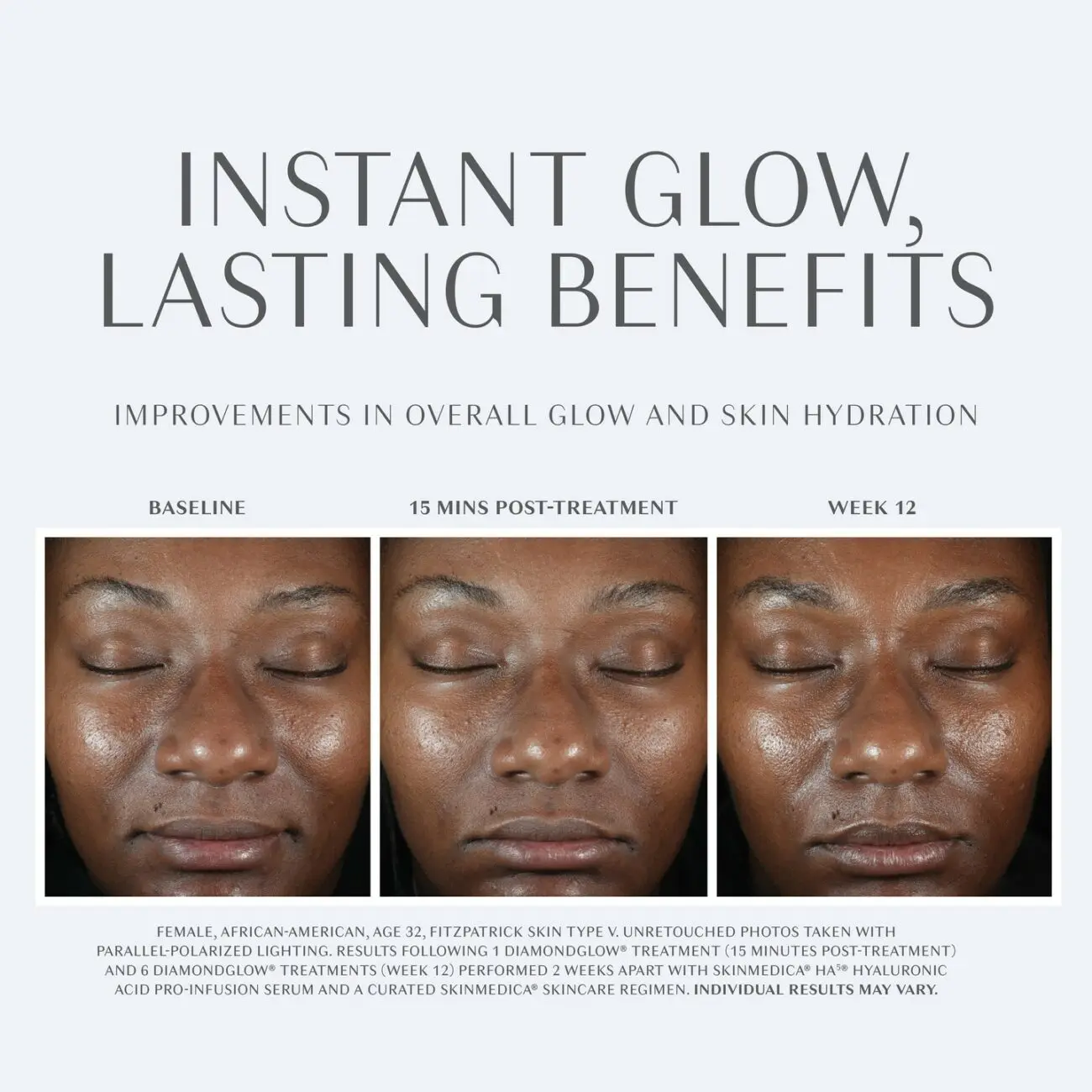 DiamondGlow Facial Swansea IL DiamondTome Facial St Louis diamondglow-facial-swansea-il-diamondtome-facial-st-louis