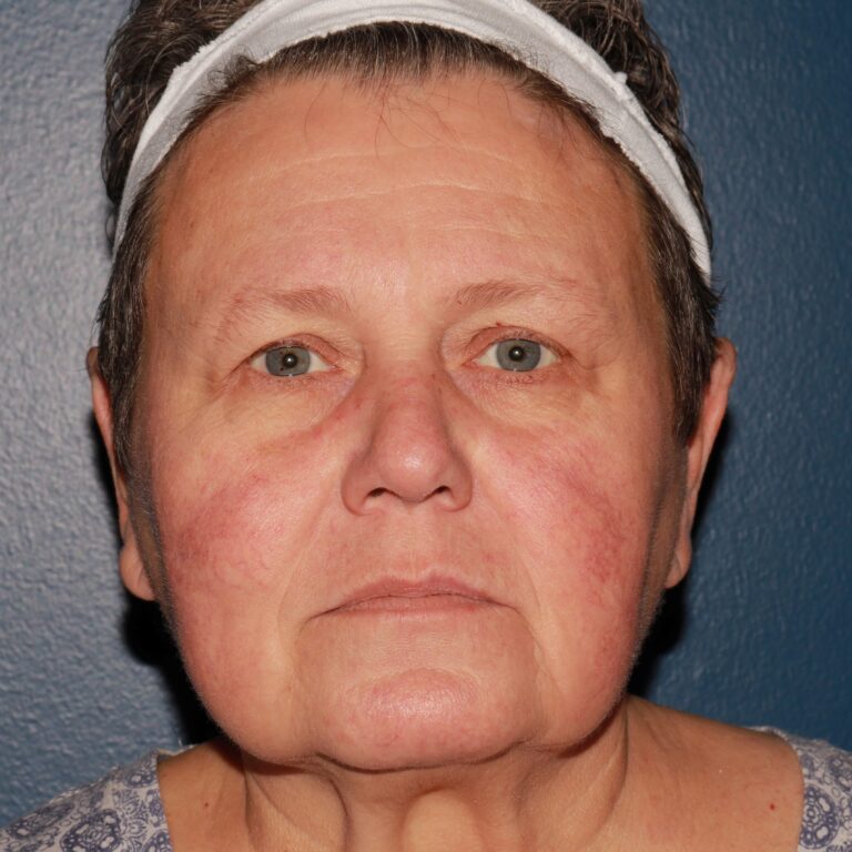 Gallery - Musick Dermatology & Advanced Clinical Spa