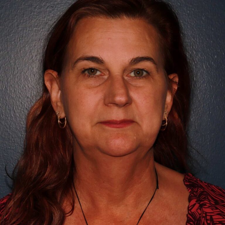 Gallery - Musick Dermatology & Advanced Clinical Spa